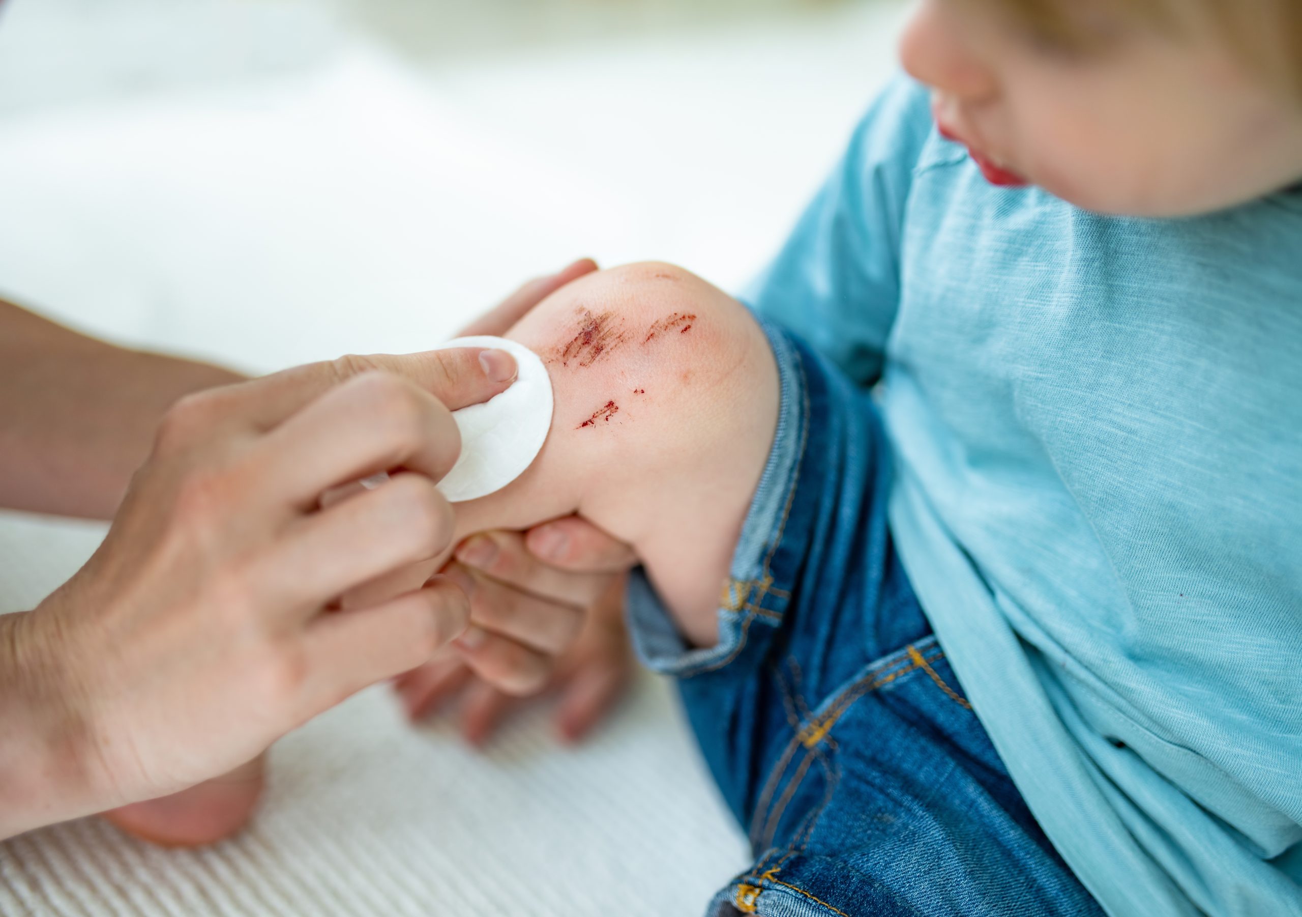 Порезы и кровоточащие раны у детей. Лечим правильно